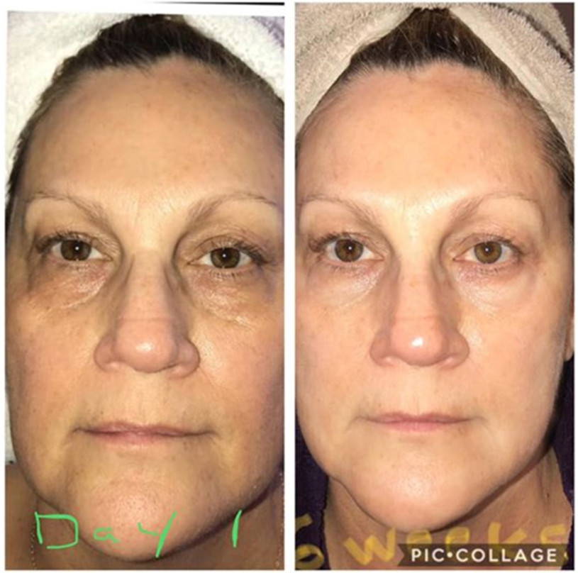 How Women are Saving $1000’s With This Revolutionary Device