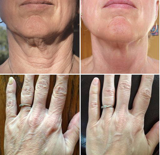 How Women are Saving $1000’s With This Revolutionary Device