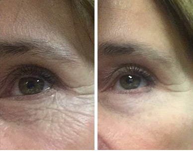 How Women are Saving $1000’s With This Revolutionary Device